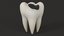 Teeth decay 3D model - TurboSquid 1438132