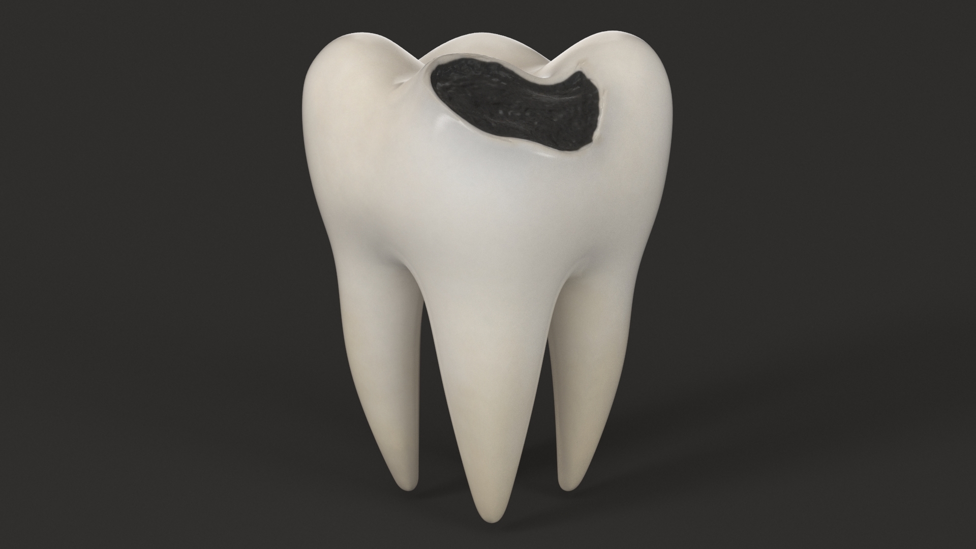 Teeth decay 3D model - TurboSquid 1438132