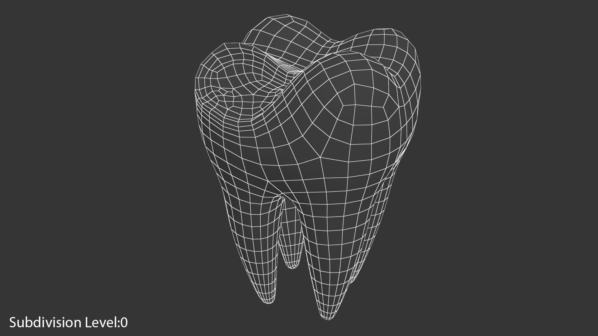 Teeth decay 3D model - TurboSquid 1438132