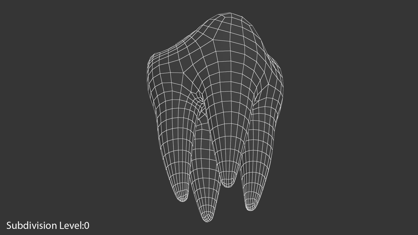 Teeth decay 3D model - TurboSquid 1438132
