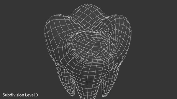 Teeth decay 3D model - TurboSquid 1438132
