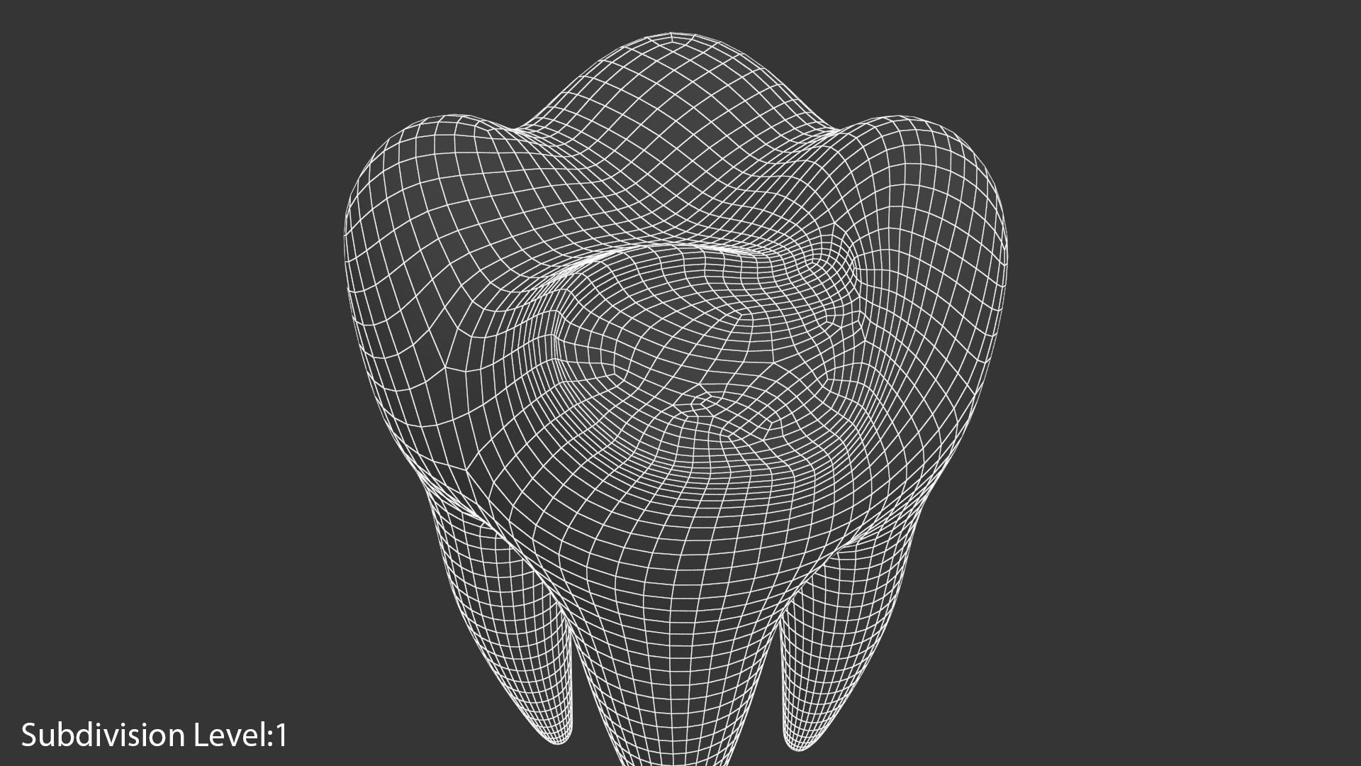 Teeth decay 3D model - TurboSquid 1438132