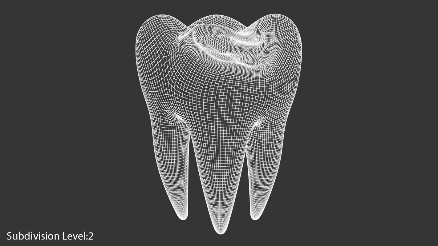 Teeth decay 3D model - TurboSquid 1438132