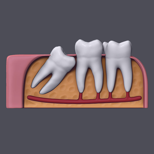 Dientes STL Modelos para Descargar | TurboSquid
