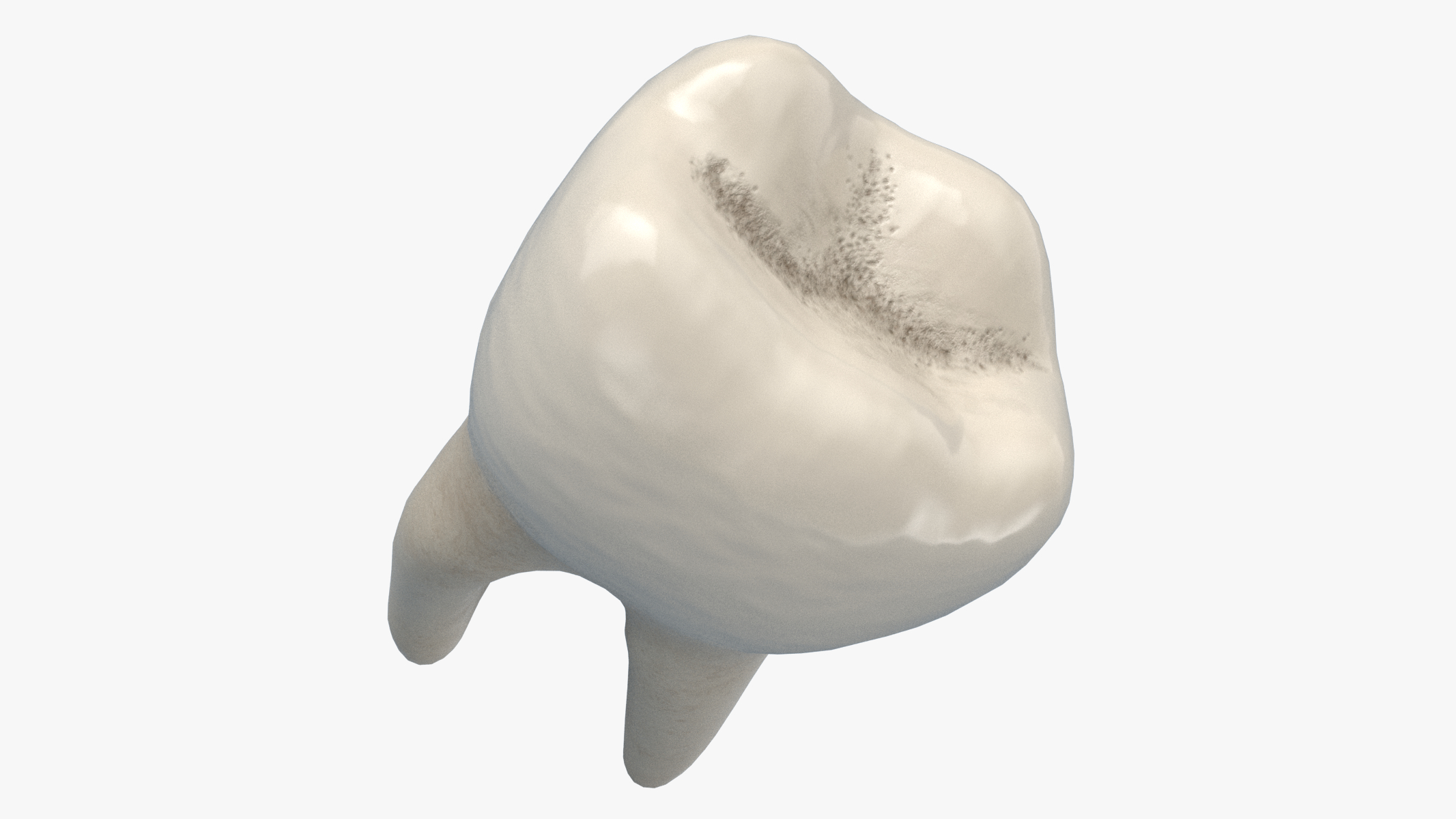 Molar tooth 3D model - TurboSquid 1489906
