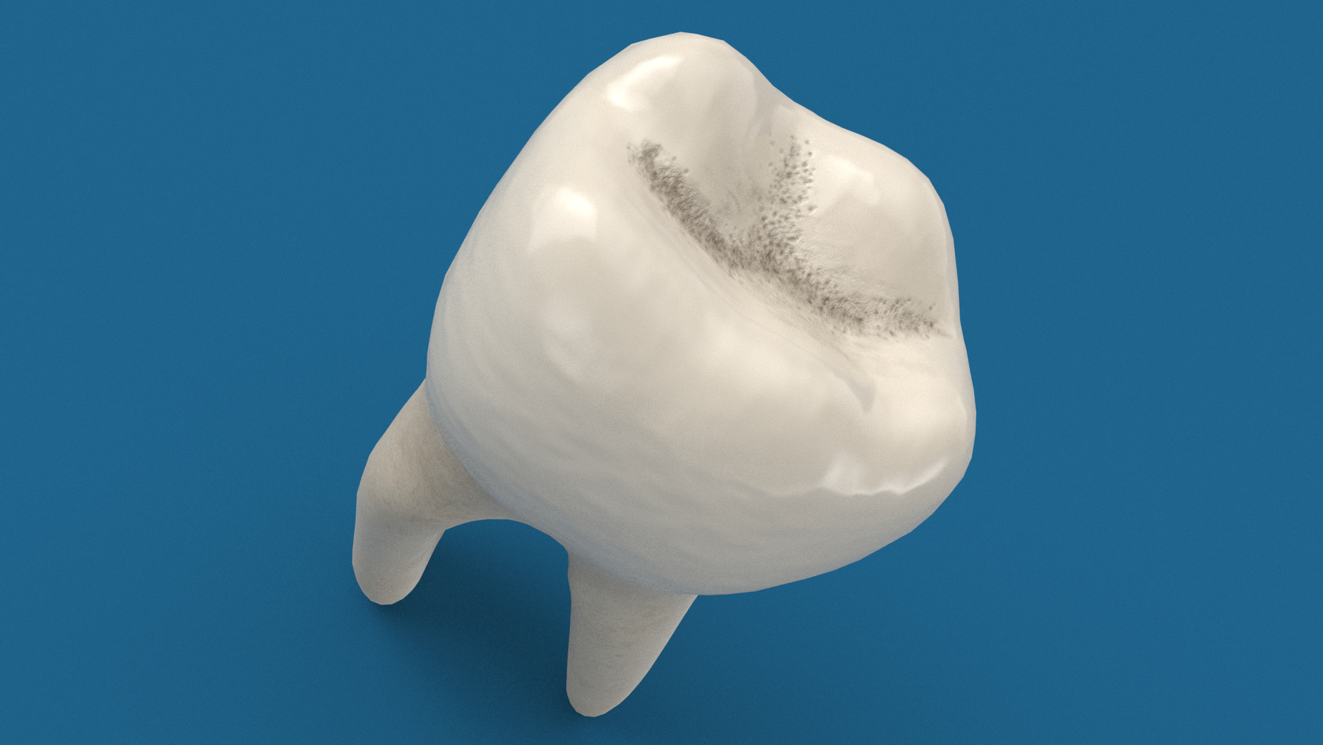 Molar tooth 3D model - TurboSquid 1489906