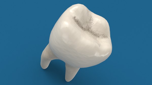 Molar tooth 3D model - TurboSquid 1489906