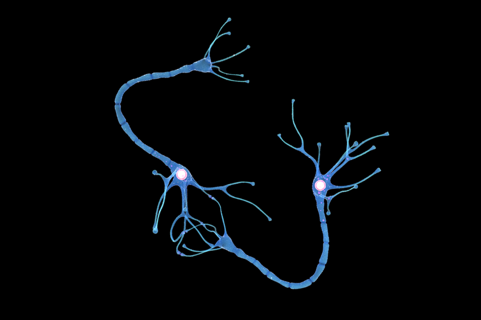 3D model nerve cell anatomy details - TurboSquid 1515693