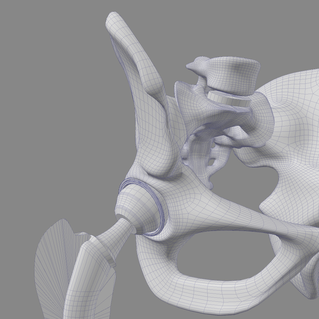 Replacement hip 3D - TurboSquid 1520195