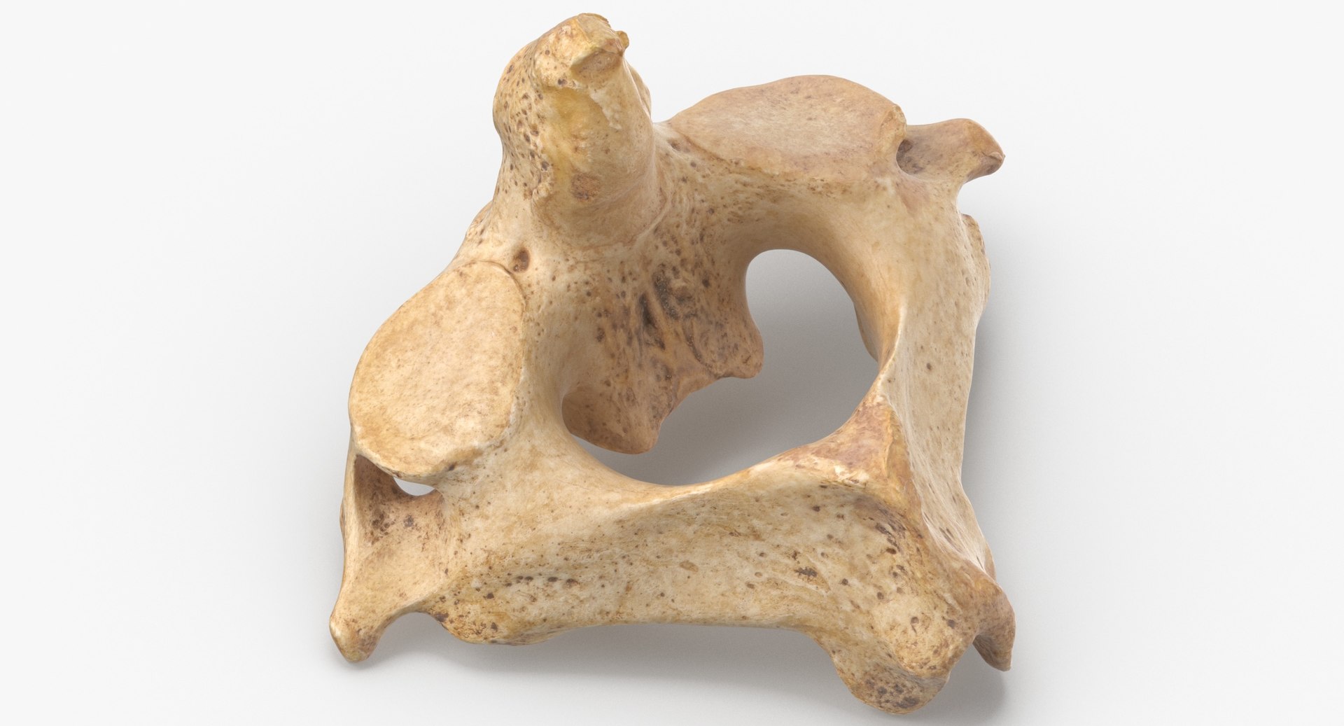 Cervical vertebrae c2 axis 3D model - TurboSquid 1520453