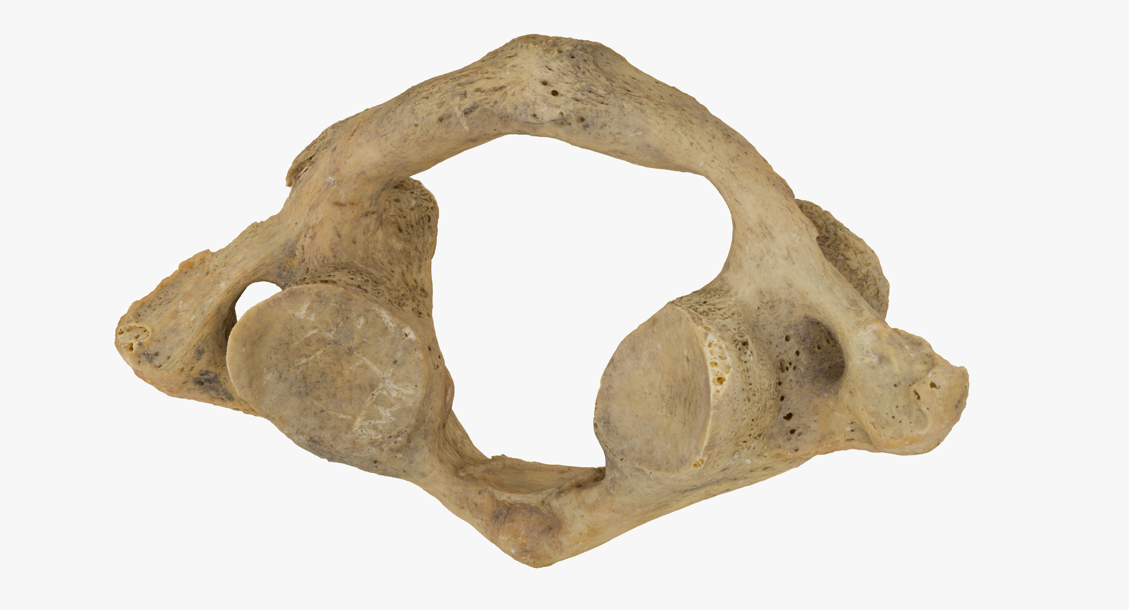 modelo 3d Vértebras cervicales reales C1 Atlas RAW SCAN - TurboSquid ...