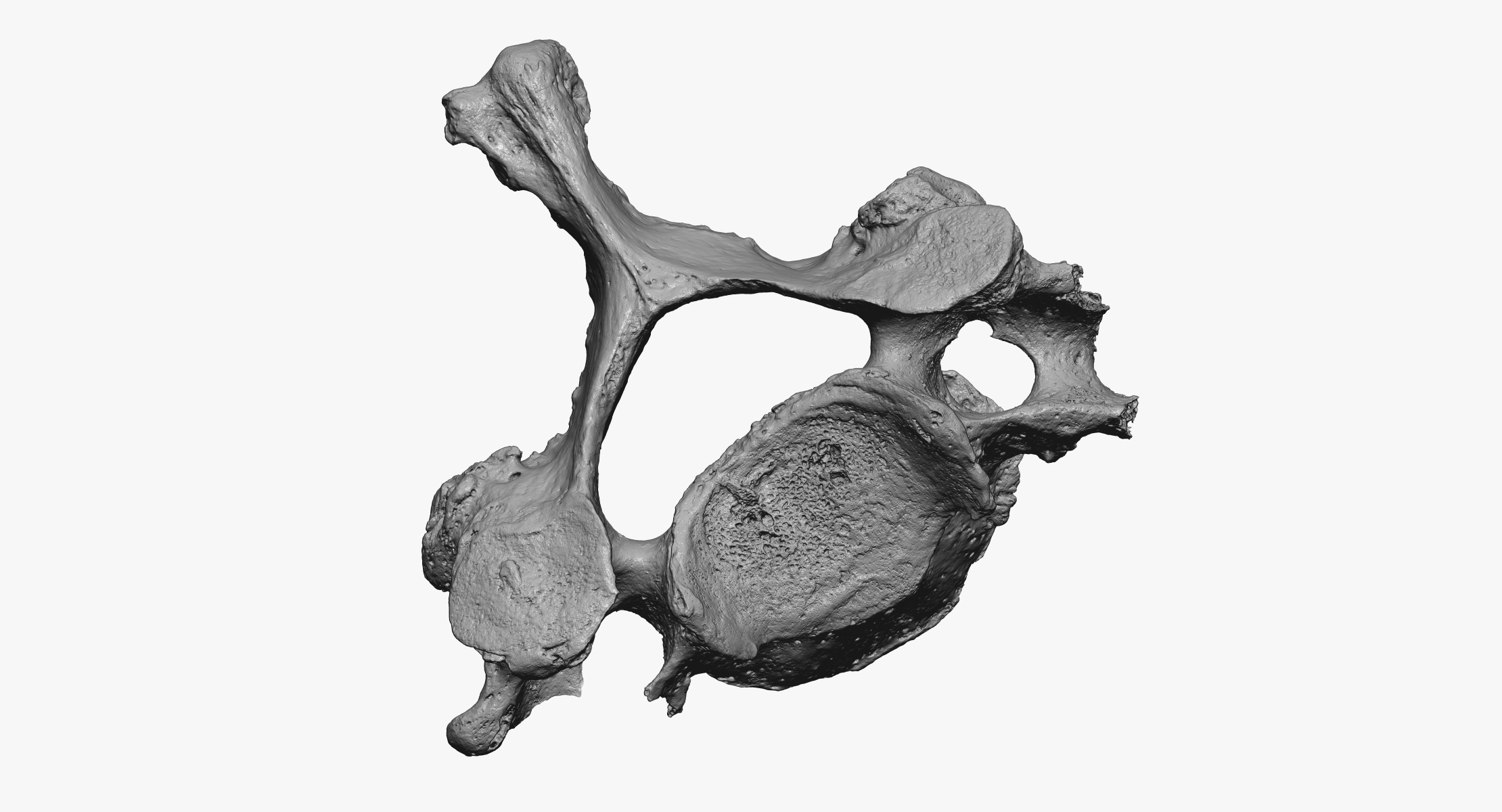 3D model cervical vertebrae c7 raw - TurboSquid 1533809
