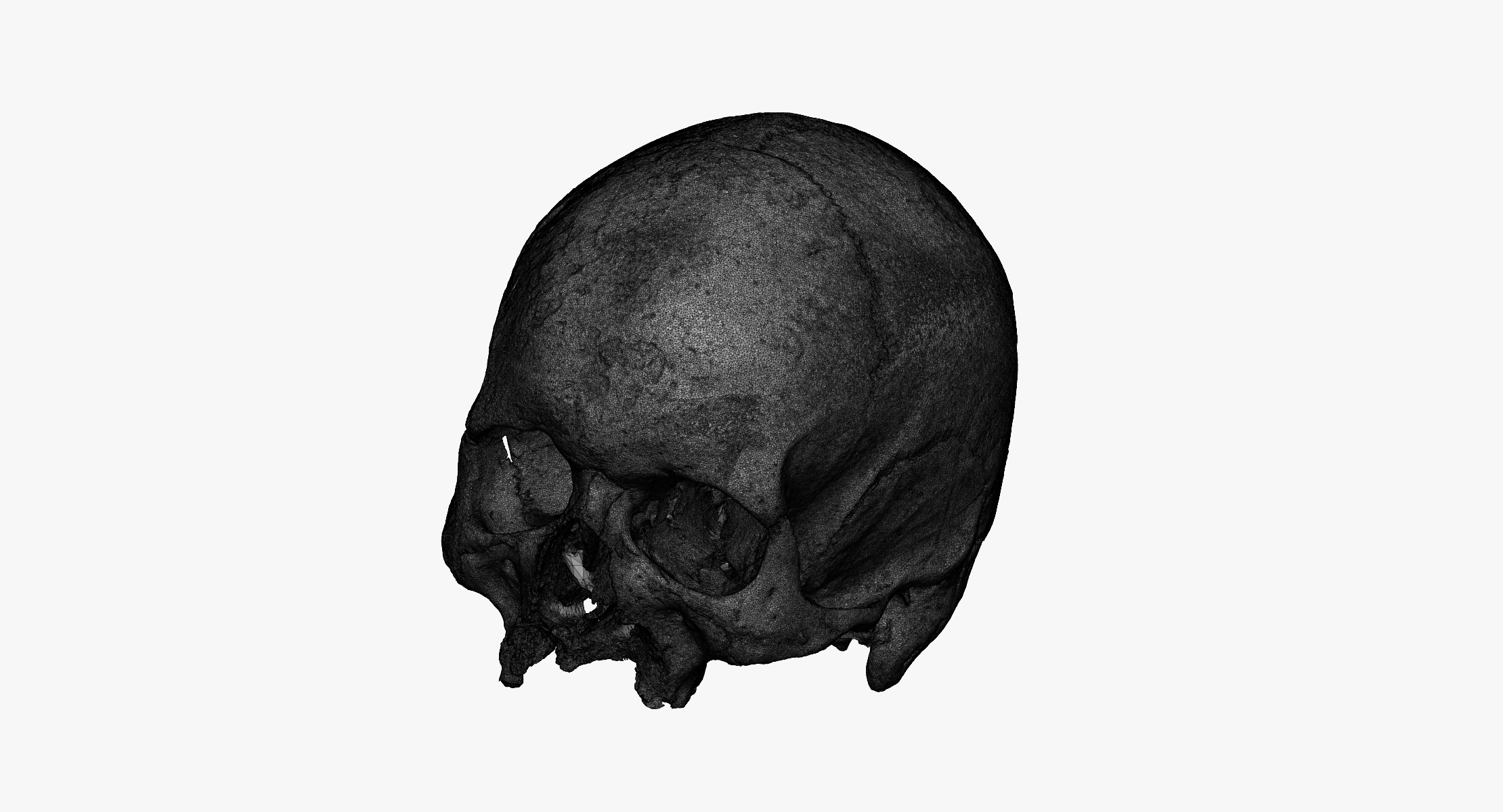 Human skull cranium leprosy 3D model - TurboSquid 1537164