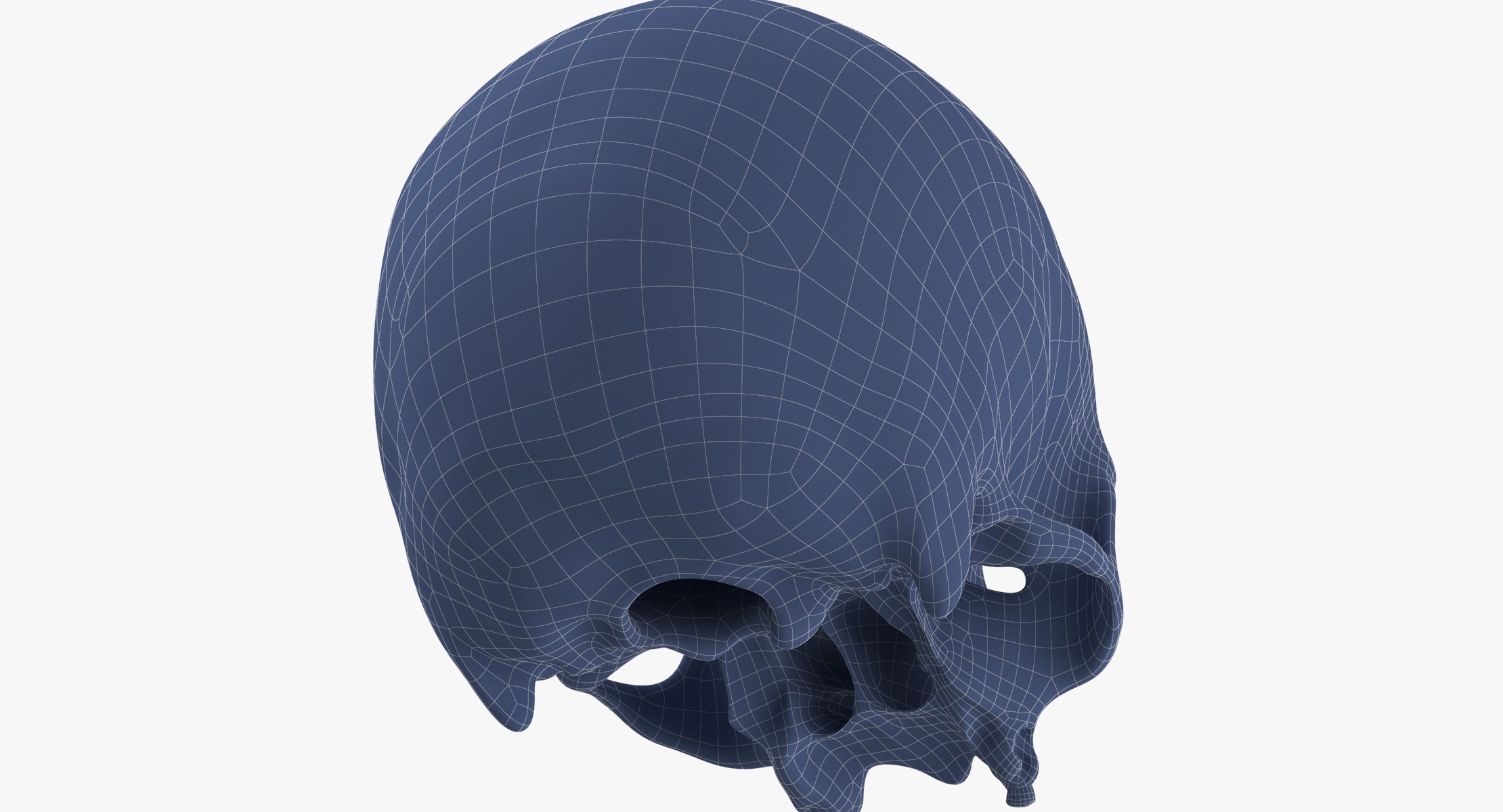 Human skull cranium leprosy 3D model - TurboSquid 1537597