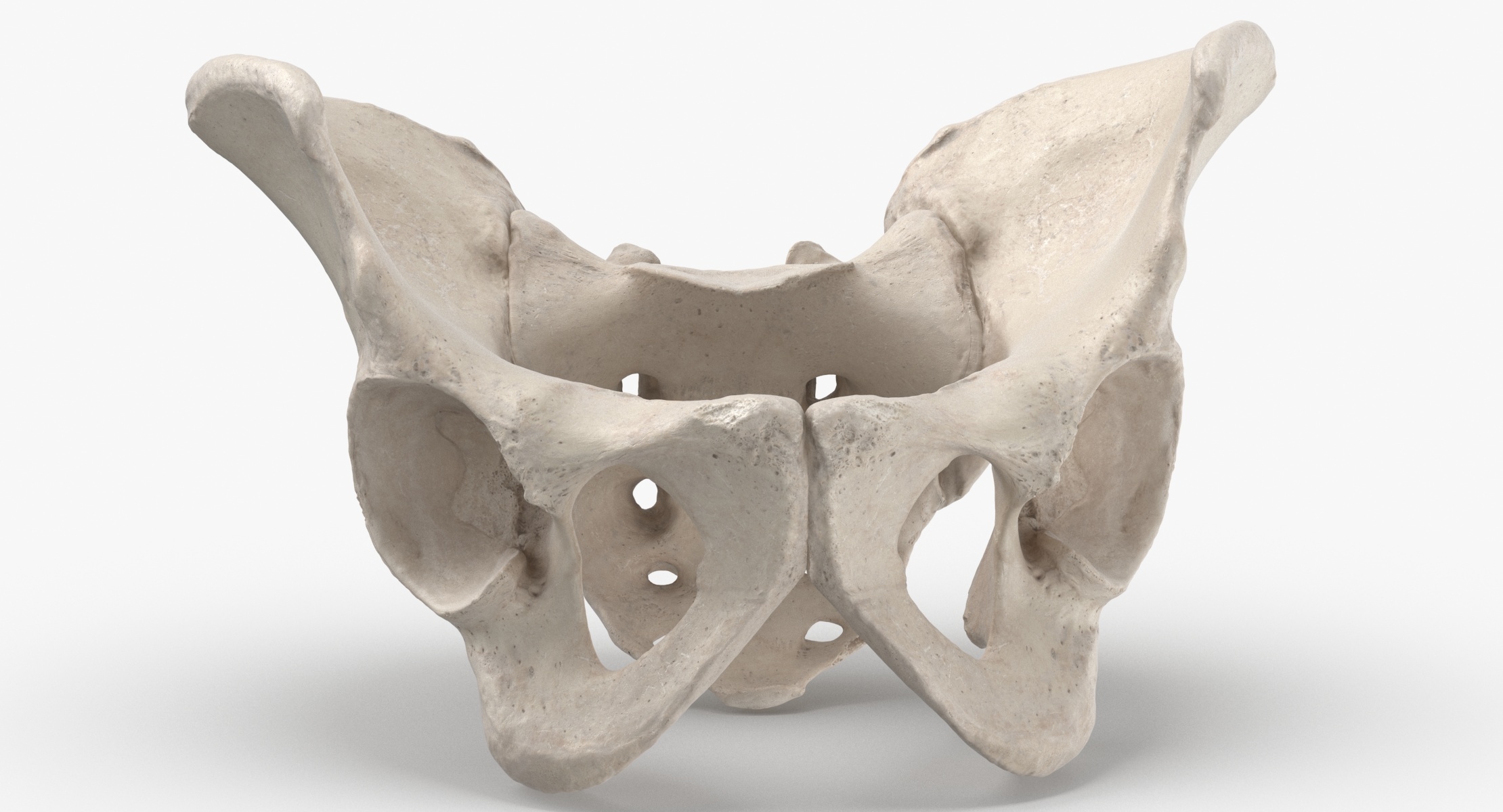 3D human pelvis damaged sacrum model - TurboSquid 1546713