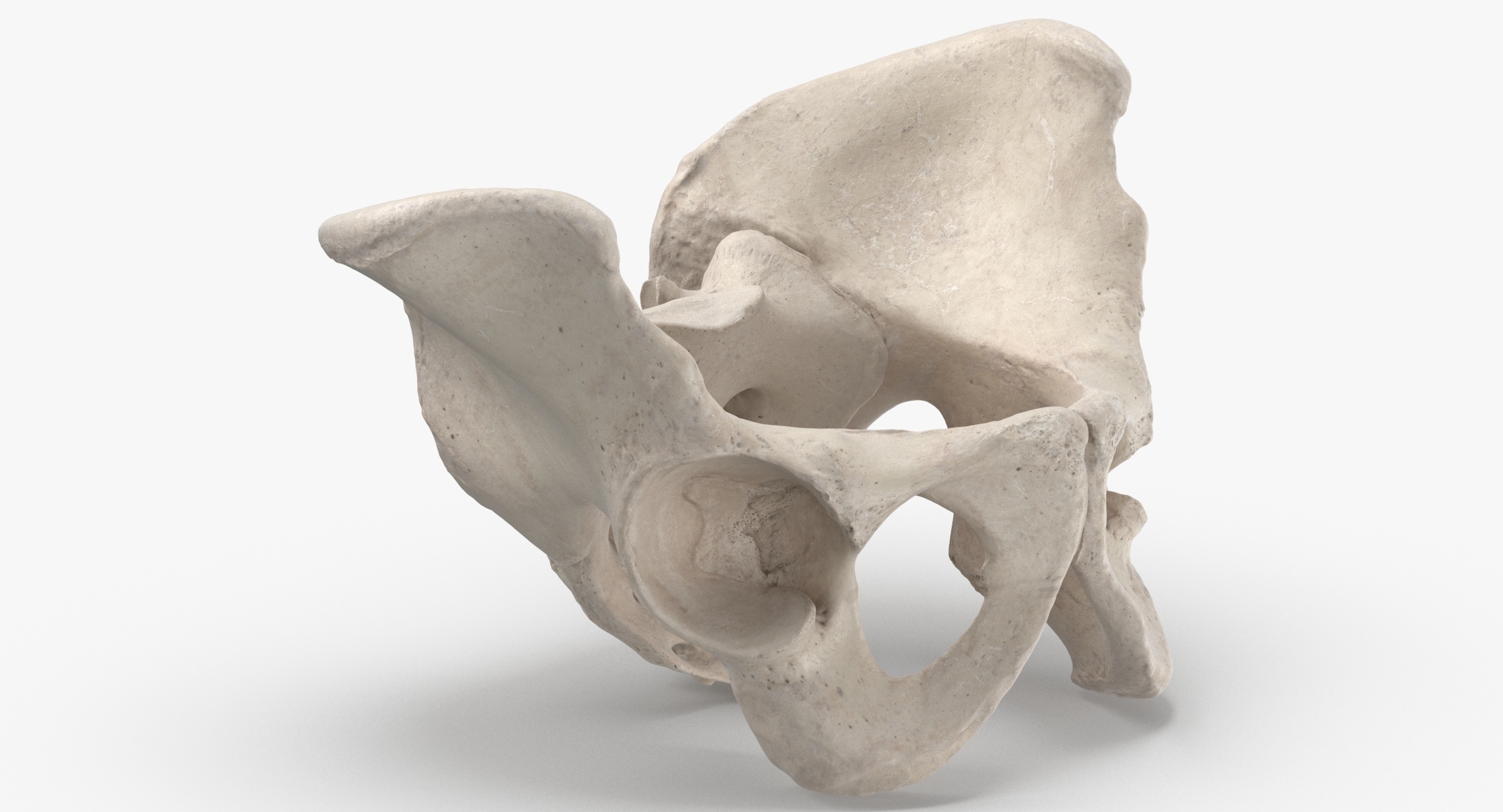 3D human pelvis damaged sacrum model - TurboSquid 1546713