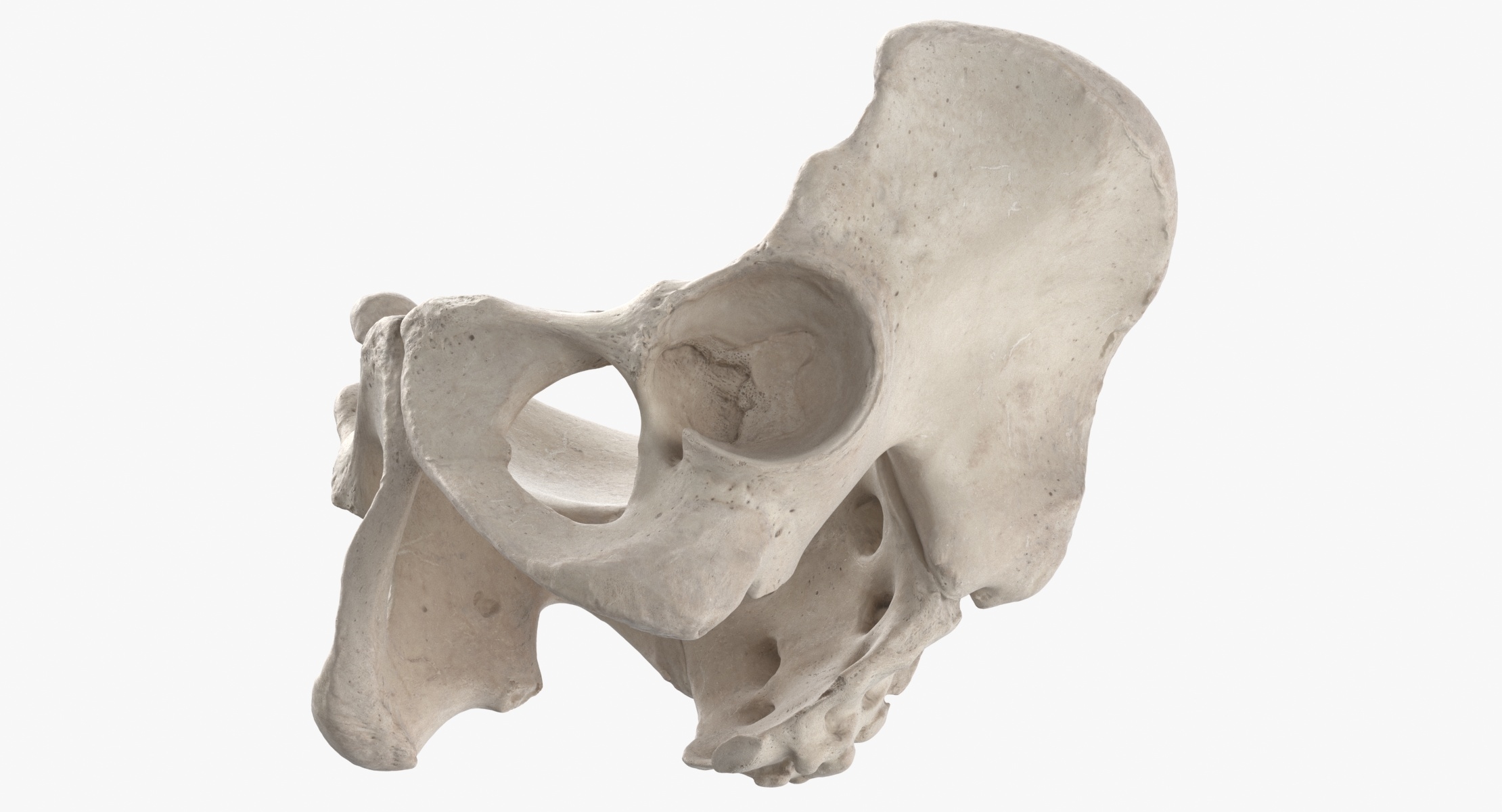3D human pelvis damaged sacrum model - TurboSquid 1546713