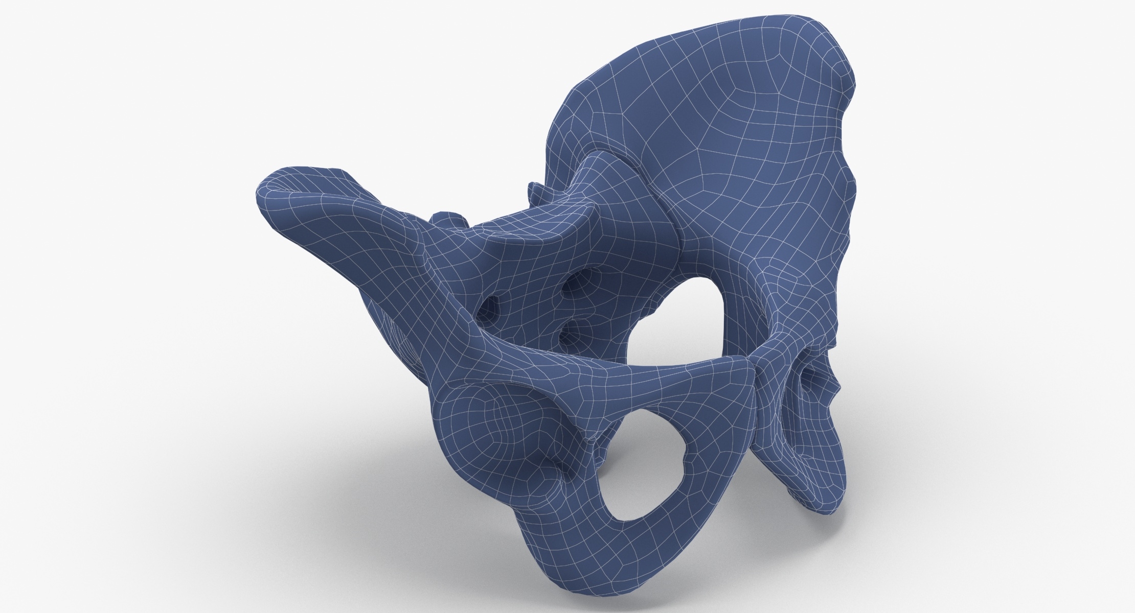 3D human pelvis damaged sacrum model - TurboSquid 1546713