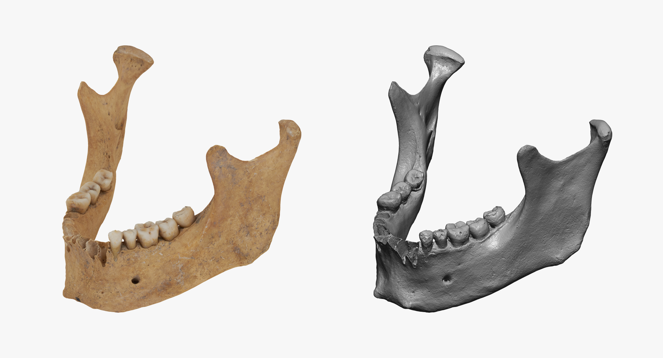 Human jawbone mandible 01 model - TurboSquid 1550984