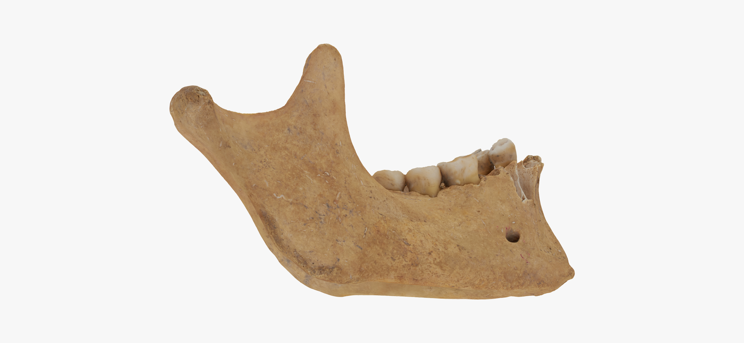 Human jawbone mandible 01 model - TurboSquid 1550984