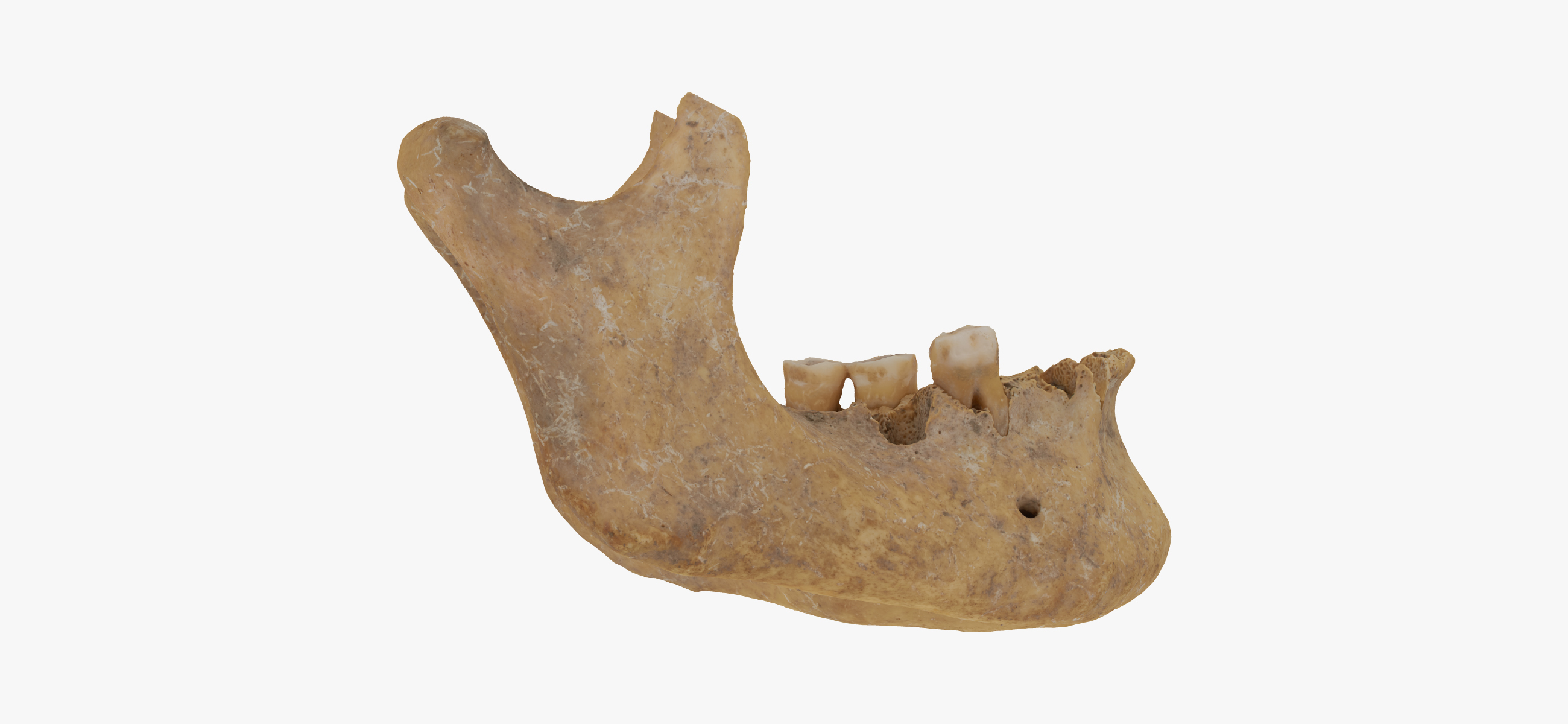 Real Human Jawbone Mandible 02 RAW SCAN 3D-Modell - TurboSquid 1550982