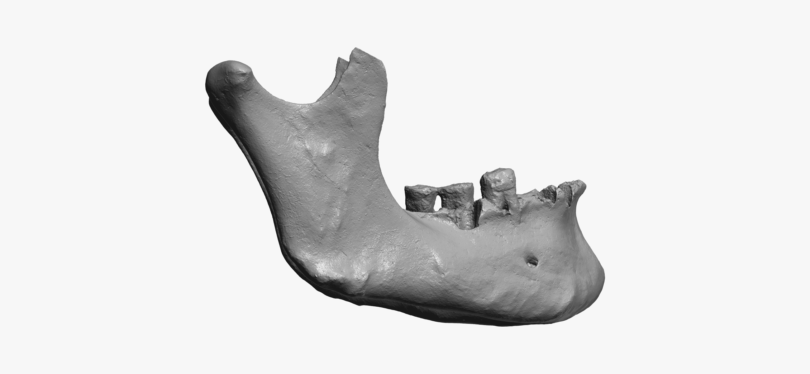 Real Human Jawbone Mandible 02 RAW SCAN 3D-Modell - TurboSquid 1550982