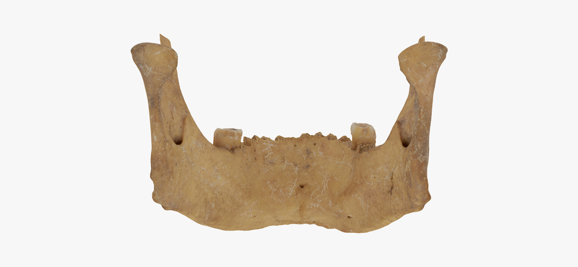 Real Human Jawbone Mandible 02 RAW SCAN 3D-Modell - TurboSquid 1550982
