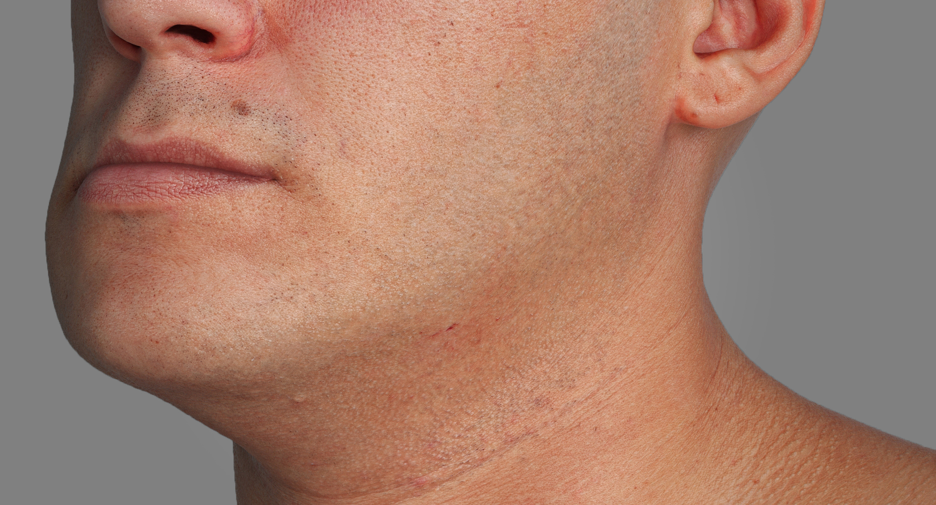 Real PBR Marcus Human Head Jaw Thrust AU29 3D-Modell - TurboSquid 1648874